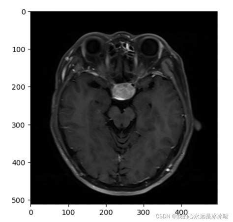 Dcm文件数据学习 Csdn博客 Dcm文件数据学习 Csdn博客