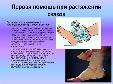 Первая помощь при травмах скелета и мышц презентация онлайн