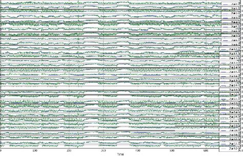 Figure 1 From Parametric System Identification Using Deep Convolutional