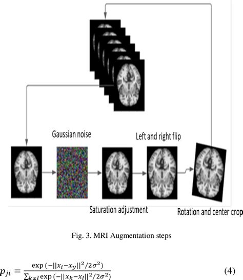 Figure 2 From Detection Of Alzheimers Disease Using Graph Regularized Convolutional Neural