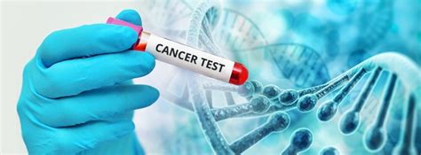 Хуулийн шинэчлэл Хавдрын эмчилгээнд ороход иргэн төлбөр төлөхгүй