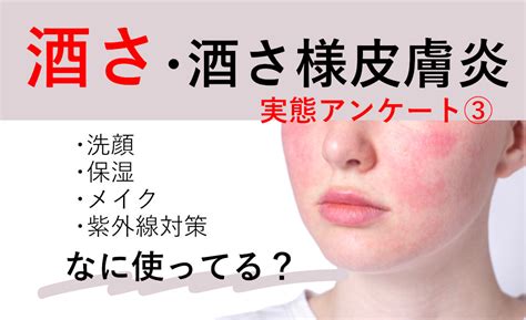 【酒さ・酒さ様皮膚炎アンケート】3スキンケア・メイク何使ってる？ 敏感肌ナビ