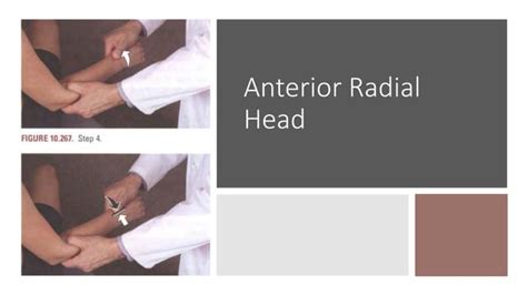 Spencers Technique1 2 9 8 6 297895 Pptx