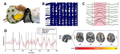 Real Time Event Detection In Simultaneous EEG FMRI Application To Epilepsy And Brain