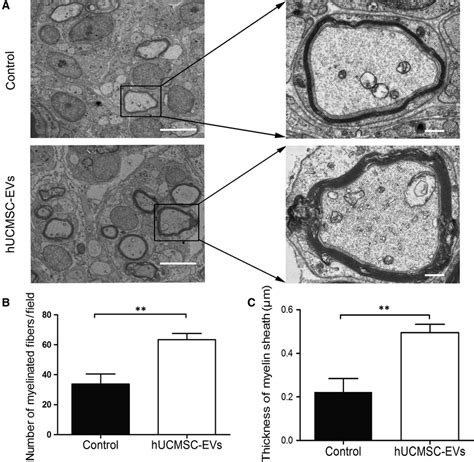 Human Umbilical Cord Msc‐derived Extracellular Vesicles Hucmsc‐evs