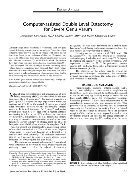 Pdf Computer Assisted Double Level Osteotomy For Severe Genu Varum