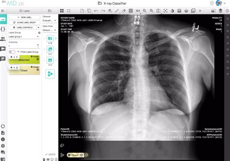 Model Performance Mdai Documentation