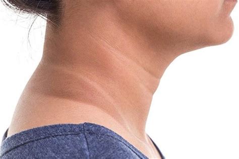 Black Neck Darkening Of Skin Around Neck Shathayu Ayurveda