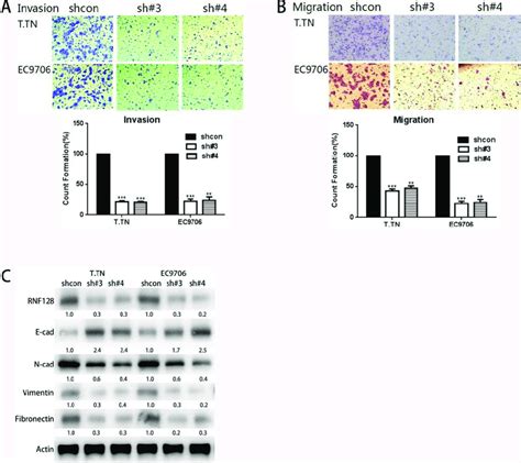 Rnf128 Knockdown Repressed Escc Cell Migration And Invasion In Vitro