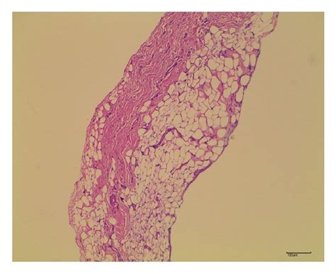 The Hematoxylin And Eosin Staining Of Synovium Corresponding To
