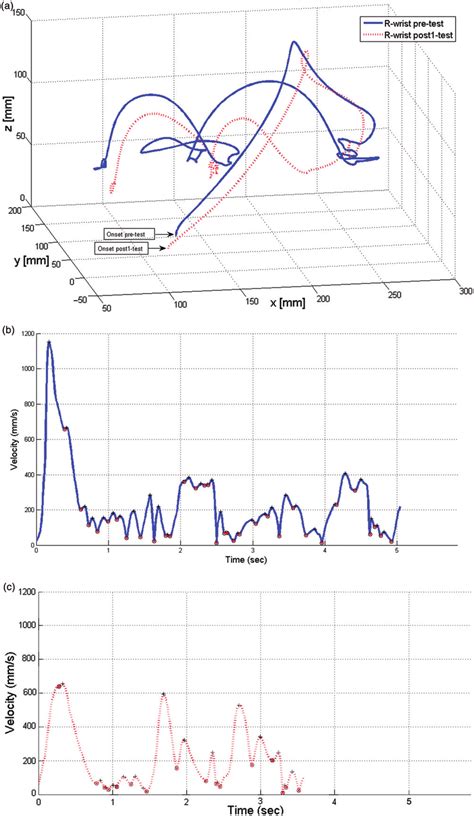 A Example Of A 3d Spatial Plot Of The Affected Right Distal Arm