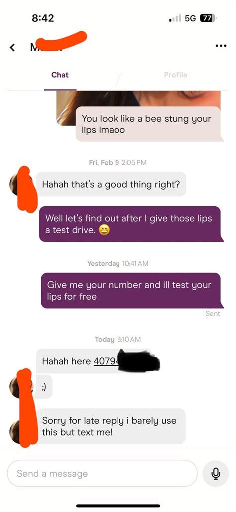 Bee Sting Lips R Greatconvodump