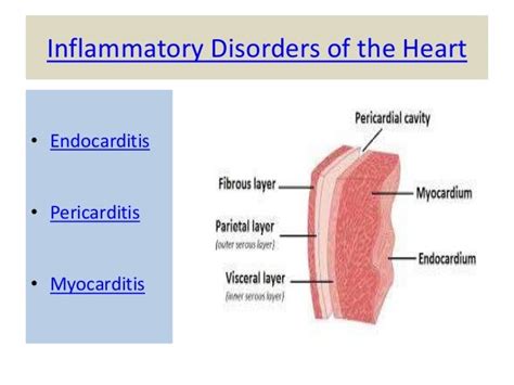 Myocarditis