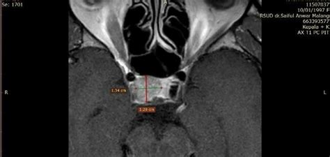 Head Mri T1 Axial View Download Scientific Diagram
