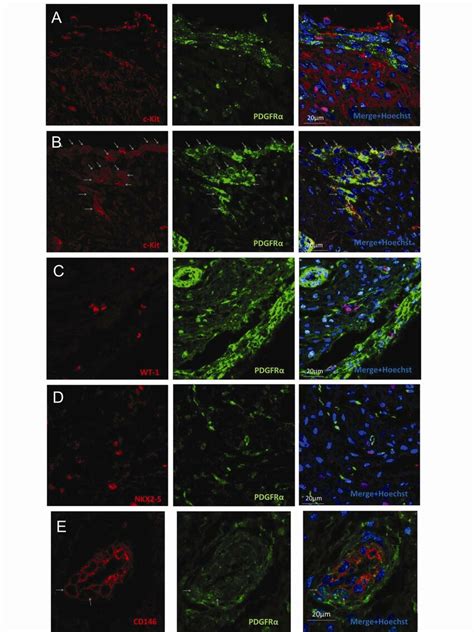 Pdgfrα Co Expression With C Kit Cardiac Stemprogenitor Cell Marker In