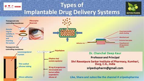 Types Of Implantable Drug Delivery Systems Youtube