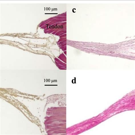 Evaluation Of Elastica Van Gieson Staining In All Groups A D3 And B D5