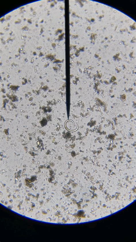 Did Someone Say Raving Nematode Rmicroscopy