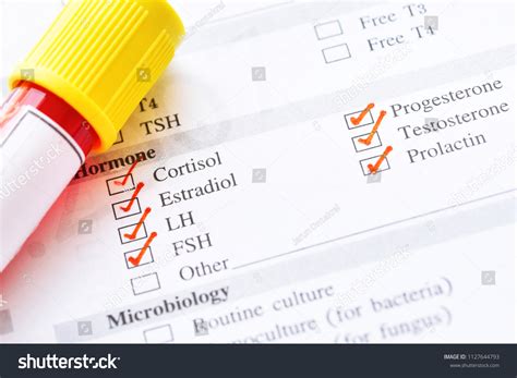 Blood Sample Tube Laboratory Requisition Form ภาพสตอก แกไขตอนน