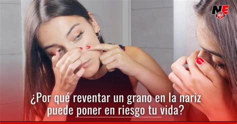 ¿por Qué Reventar Un Grano En La Nariz Puede Poner En Riesgo Tu Vida