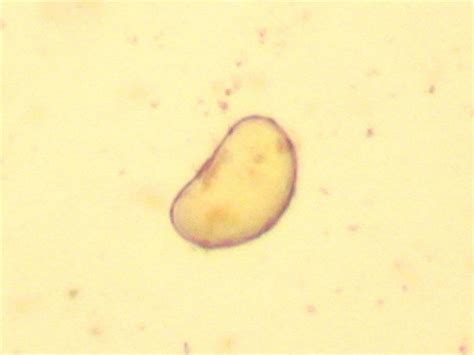 Parascreen E Equine Parasite And Horse Fecal Egg Count Testing