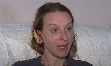 Pet Monkey Shot Dead As He Rips Womans Ear Off Outside Her Front Door
