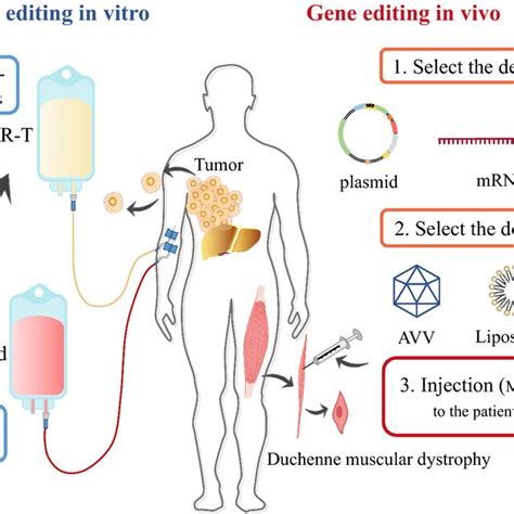 In Vivo Gene Editing Versus In Vitro Gene Editing Therapy Download