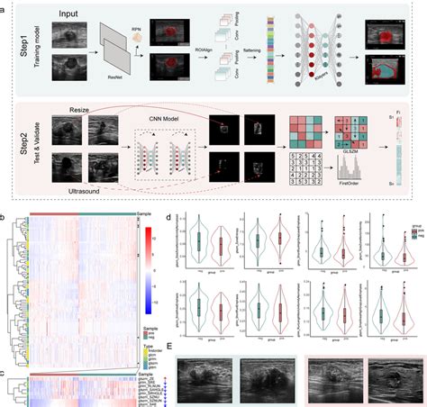 Ultrasound Images Segmentation And Her2 Status Related Urfs Extraction Download Scientific