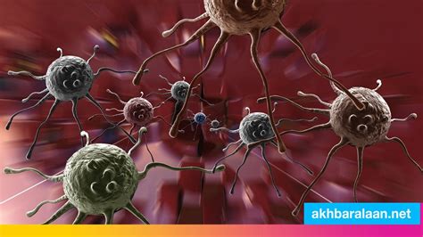 الكشف عن أكثر سبب لانتشار مرض السرطان في الولايات المتحدة دراسة