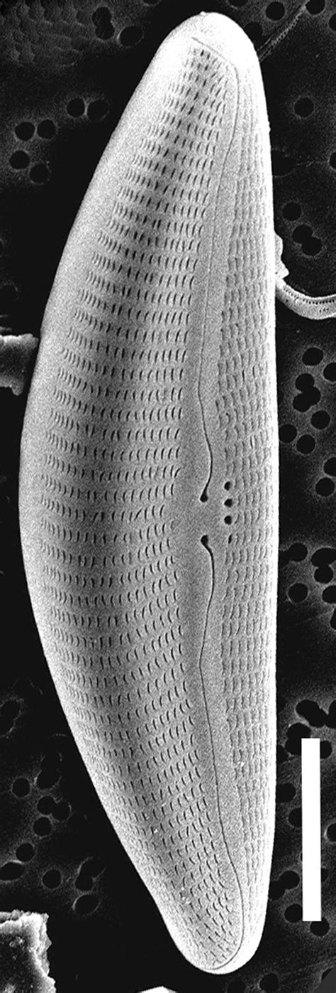 Image Cymbella Fontinalis Sem Externalwholeoblique10microns  Species Diatoms Of North America