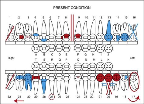 12 The Dental Examination Pocket Dentistry Dental Charting Tooth