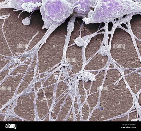 Neurones Coloured Scanning Electron Micrograph SEM Human Neurons