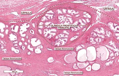 Histologia Da Prostata Rotulada