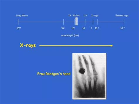 Ppt X Rays Powerpoint Presentation Free Download Id6591882