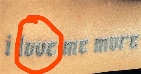 Infected Tattoo Rtattooadvice