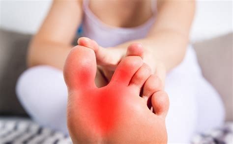 Tanda Tanda Asam Urat Di Jempol Kaki Yang Jarang Disadari Waspada Okezone Health