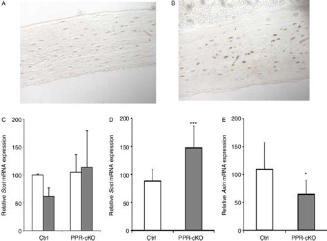 Sost And Sclerostin Expression In Ocy Ppr Cko Immunohistochemistry