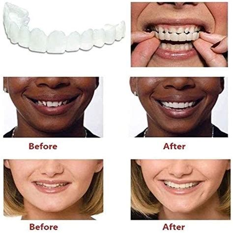 Veneer Teeth Fake Teeth Veneers Snap In Teeth Teeth Dental Veneers Instant Veneers Dentures