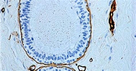 Type Iv Collagen