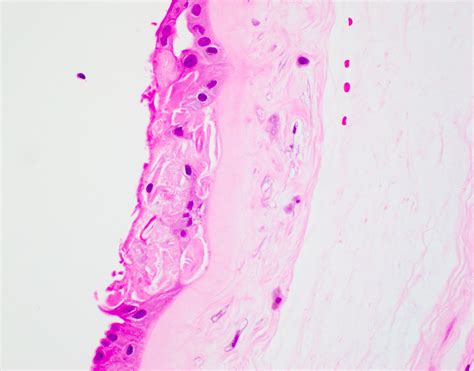 Amnion Histology