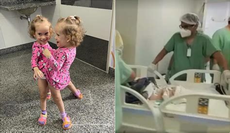 Siamesas Separadas Em Cirurgia Em Goiânia Estão Em Estado Grave