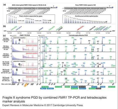 Fmr1 Cgg Repeat Expansion Mutation Detection And Linked Haplotype Analysis For Reliable And