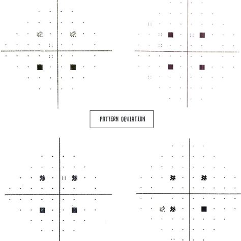 Examples Of The Four Dot Artefact On The Pattern Deviation Plot Download Scientific Diagram