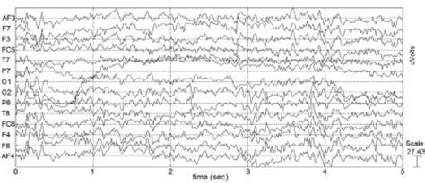 Separated Signals Obtained From The Ica Algorithm Download