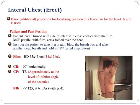 Ppt Chest Radiography Lecture2 Powerpoint Presentation Free