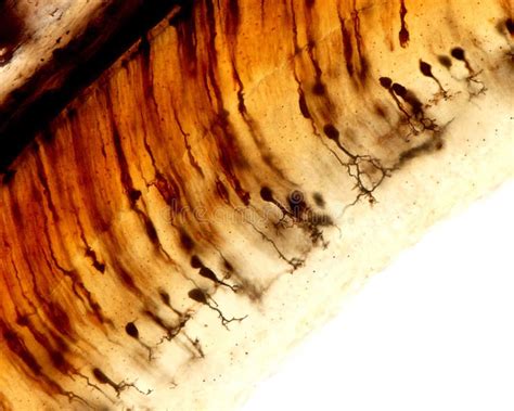 Retina Golgi Method Amacrine Cell Stock Image Image Of Microscopy