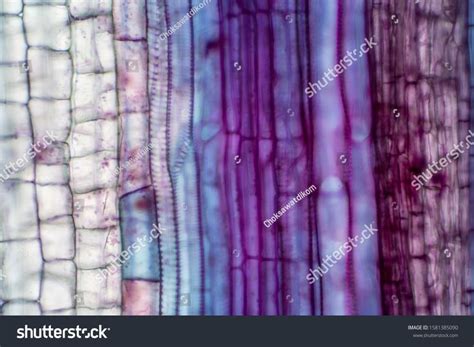 Plant Vascular Tissue Under The Microscope View For Education Ad