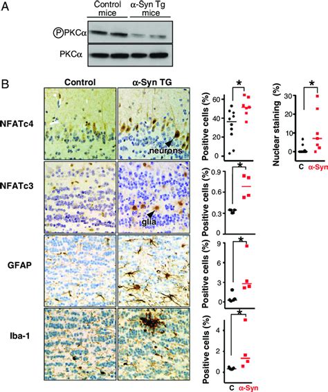 Calcineurin Substrates In α Syn Transgenic Mice A Western Blot For