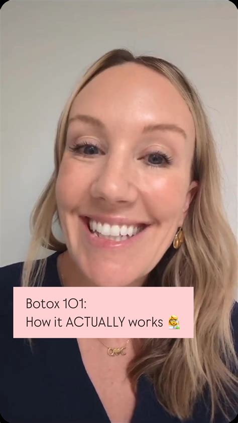 Lower Face Tox Dysport Botox Skinbeam Aesthetics