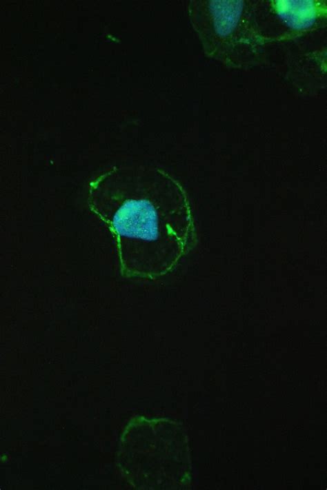 anti beta Catenin 抗体 ARG40558 arigobio 中国